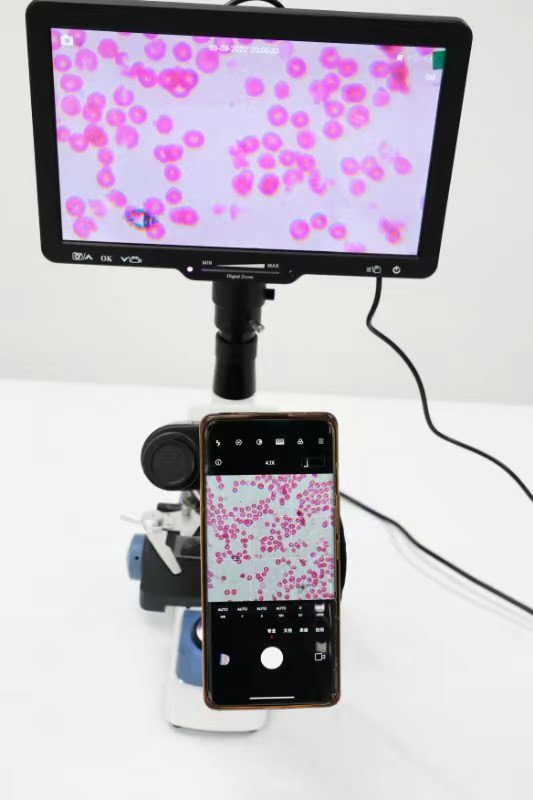 DIGITAL BIOLOGICAL MICROSCOPE with USB | AMIS MEDICAL