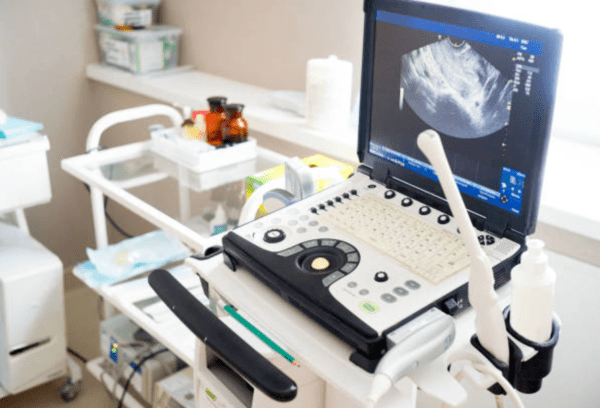 ultrasound imaging