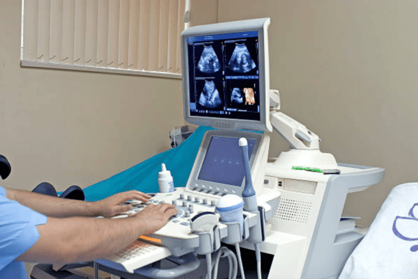 Ultrasonografía Doppler