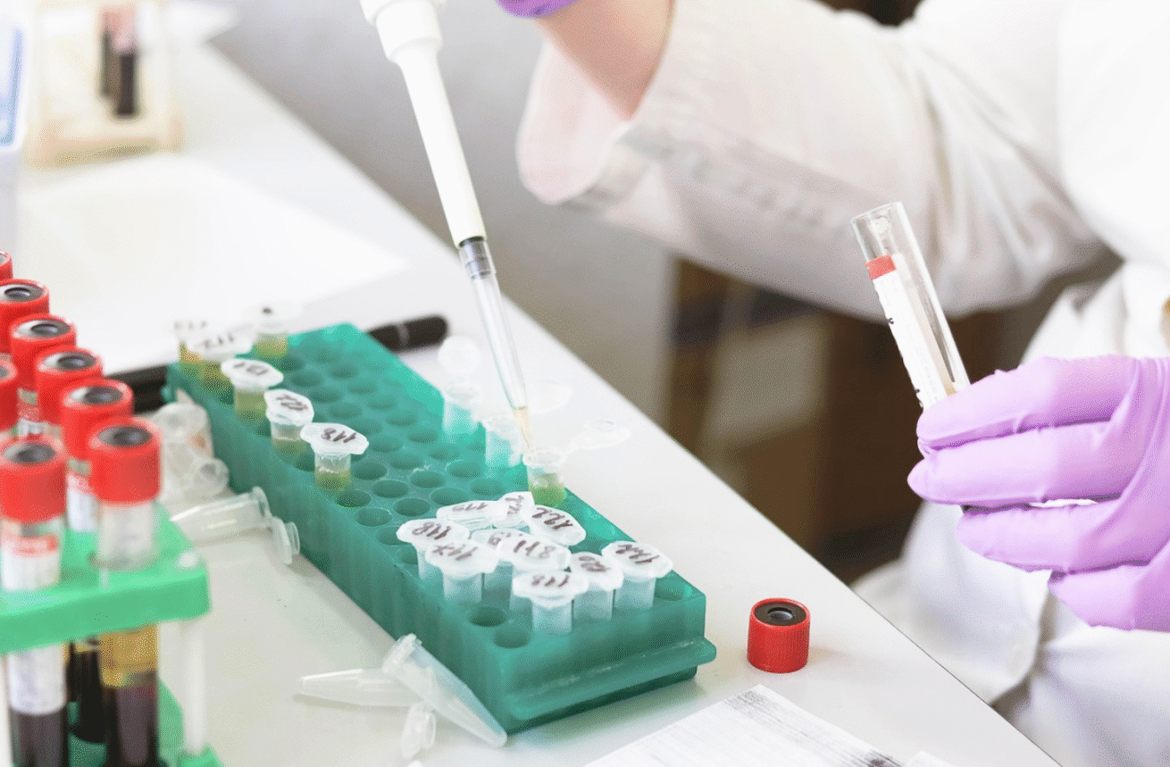 Lab Analyzers
